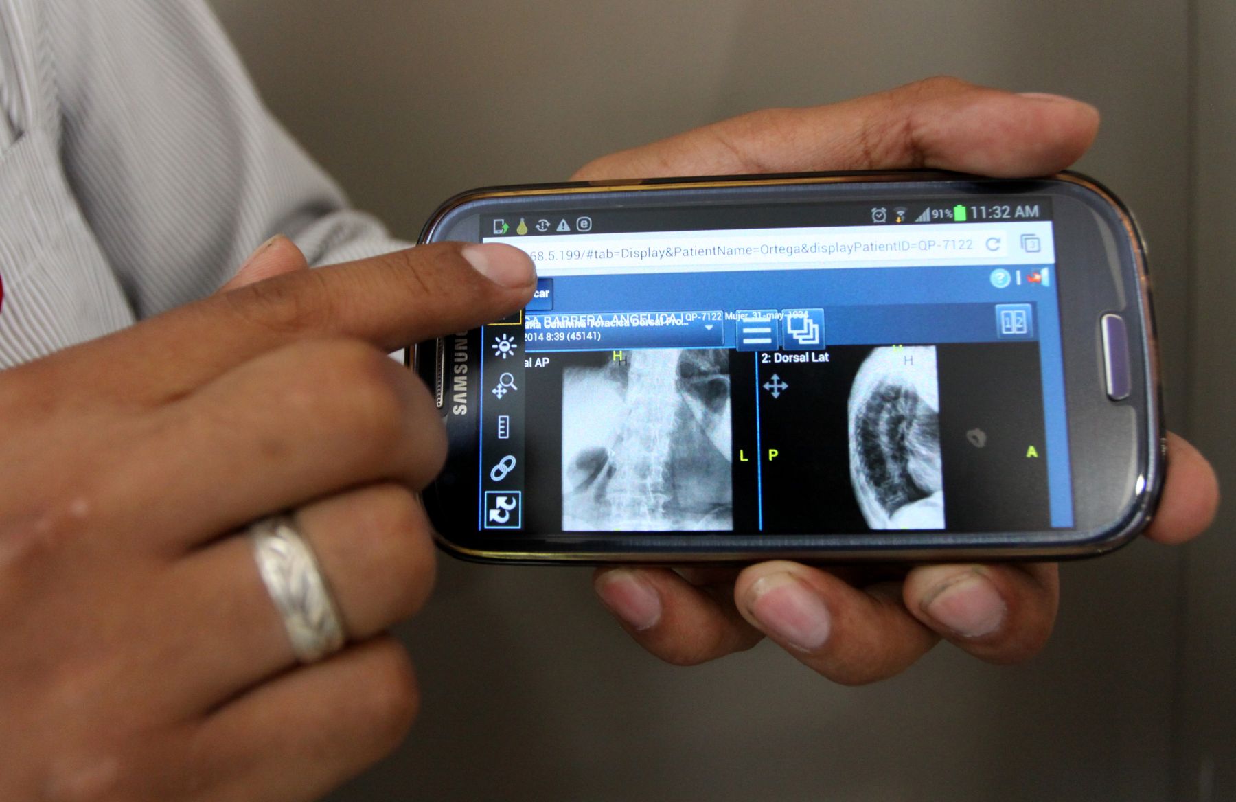 Médicos radiólogos verán exámenes de rayos X desde smartphone o tablet ...